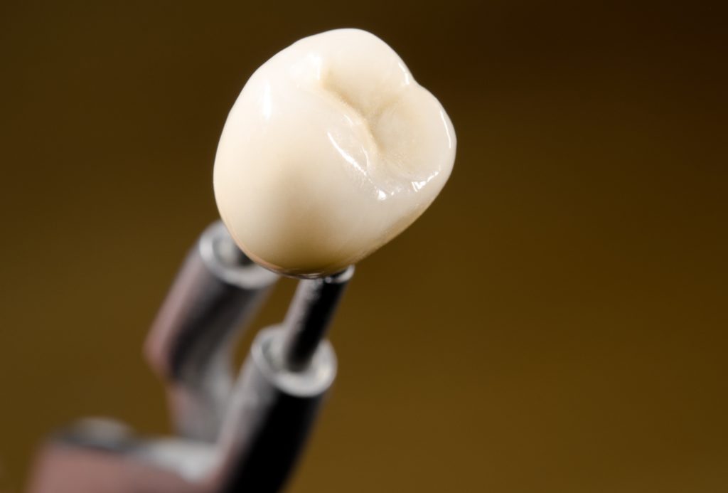 What Do I Do If I Have Lost a Dental Crown?